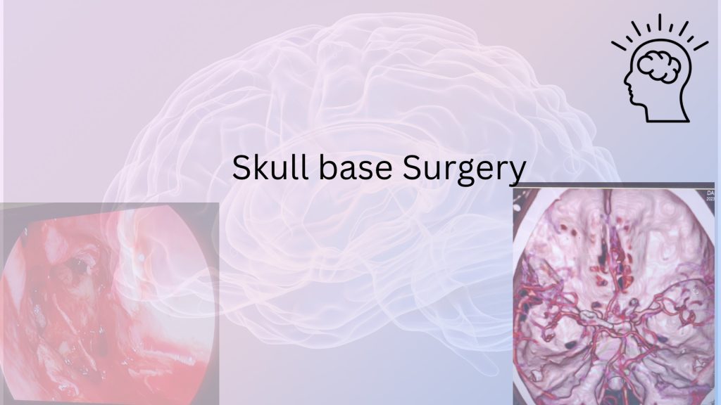 Skull Base Surgery - Dr Manoj Midha